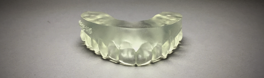 3D Printing Company ties-up with Orthodontists to Straighten teeth