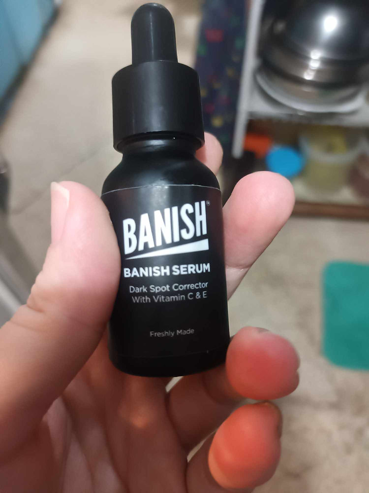 Product Review: Banish Serum – Dark Spot Corrector Vitamin C Serum