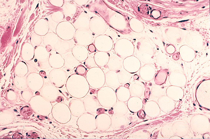 Saistaudi | organisms