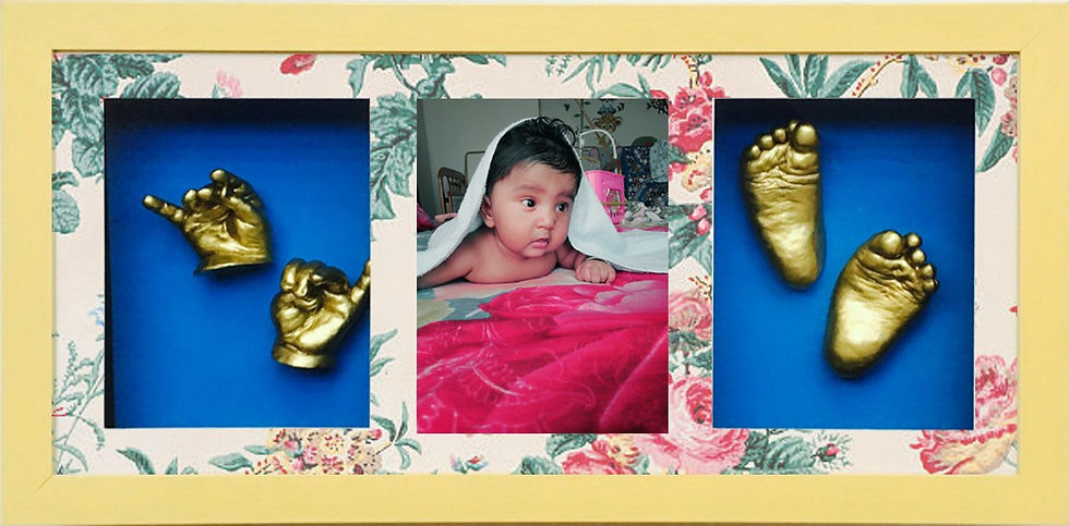 hands and feet cast Delhi