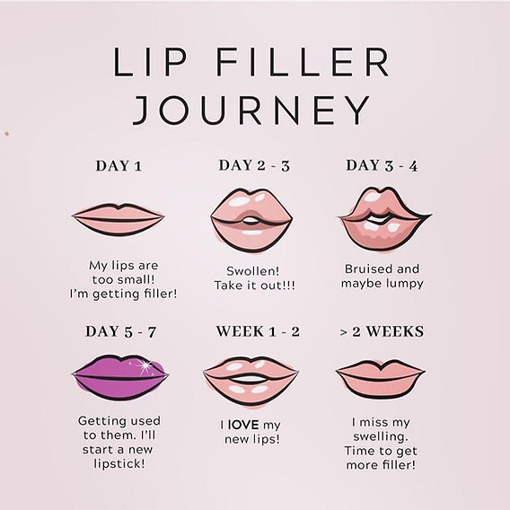 Small Bumps On Lips After Filler