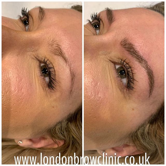 Microblading Specialist | London Brow Clinic | London