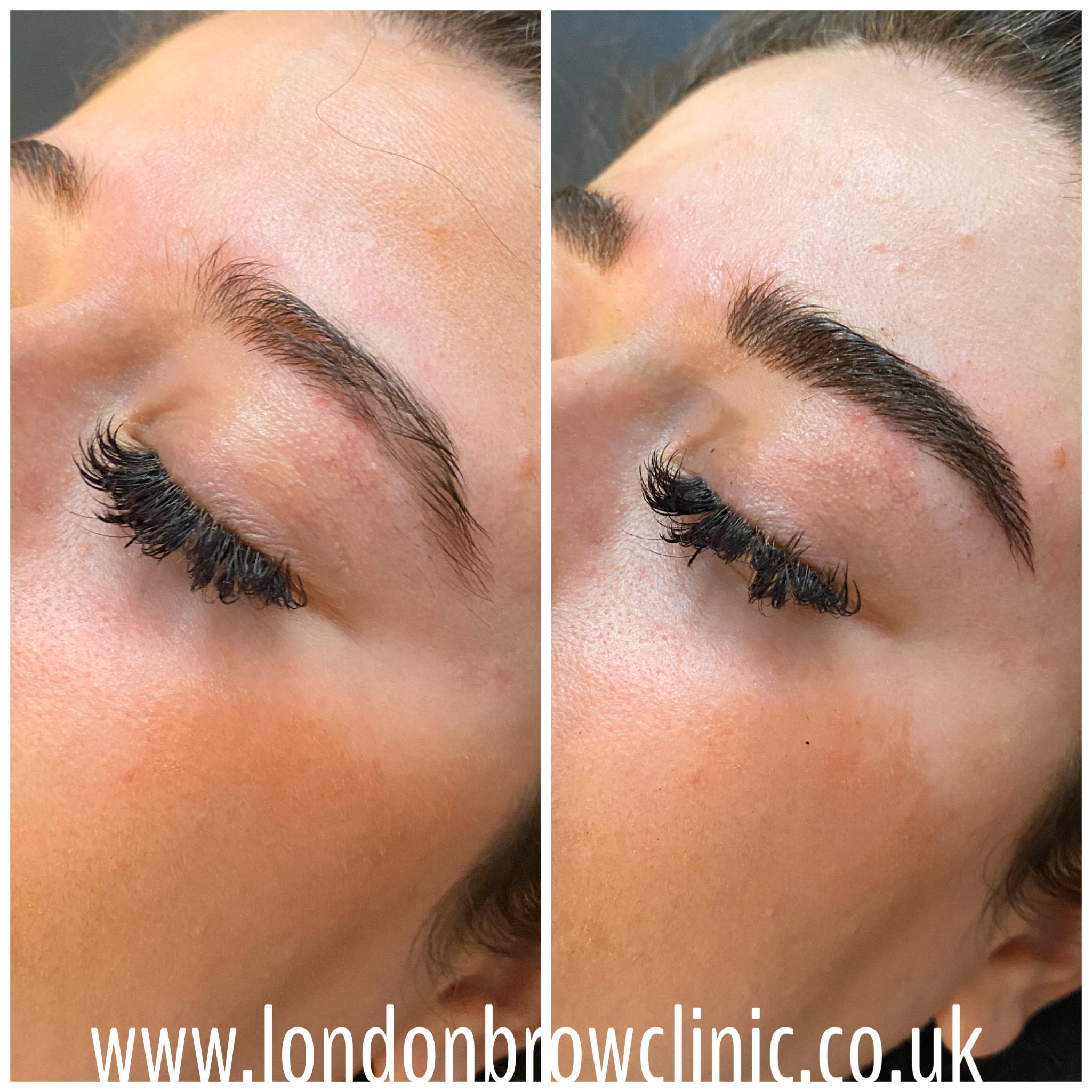 Microblading Specialist | London Brow Clinic | London
