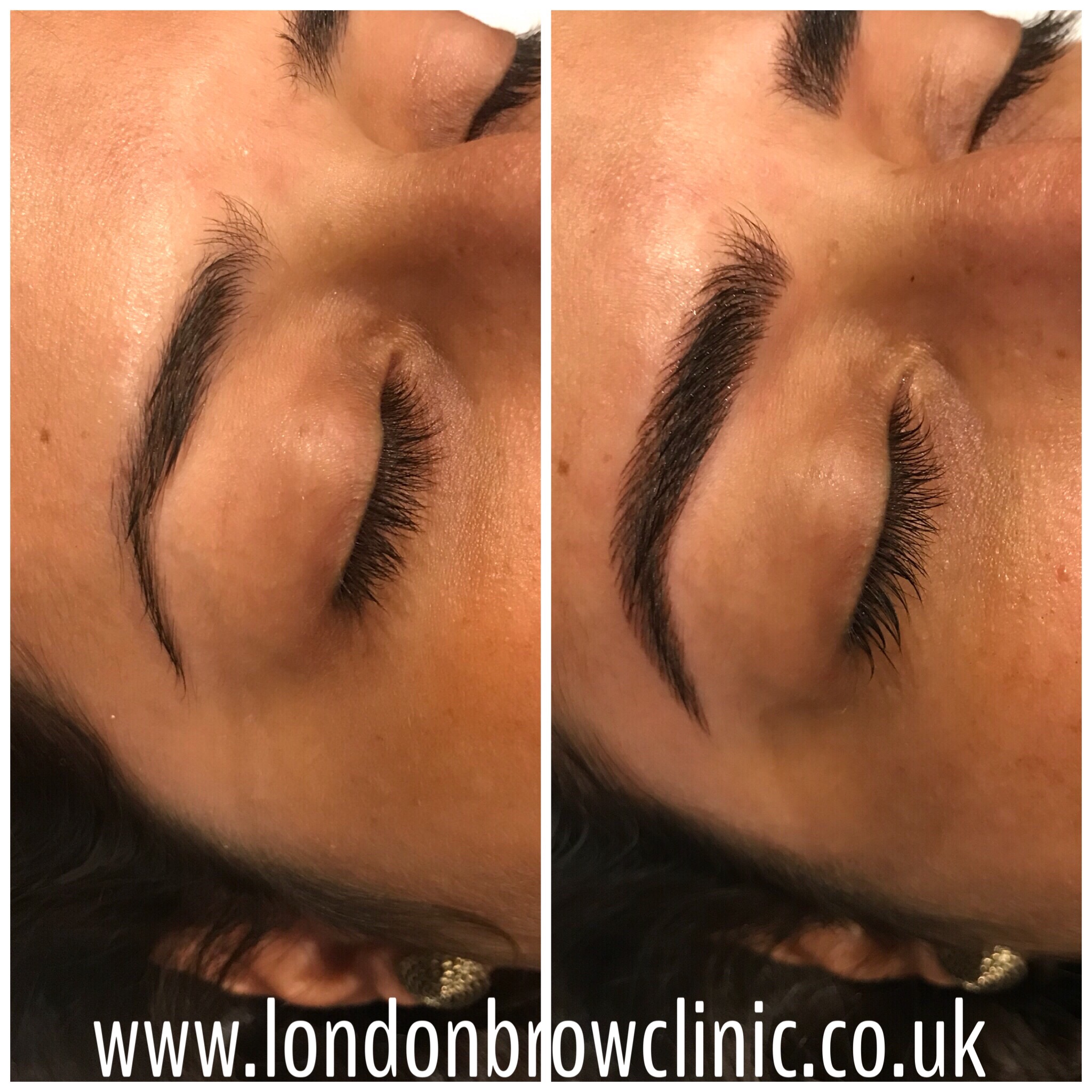 Microblading Specialist | London Brow Clinic | London