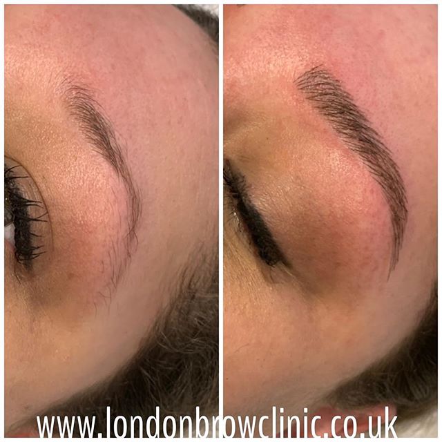 Microblading Specialist | London Brow Clinic | London