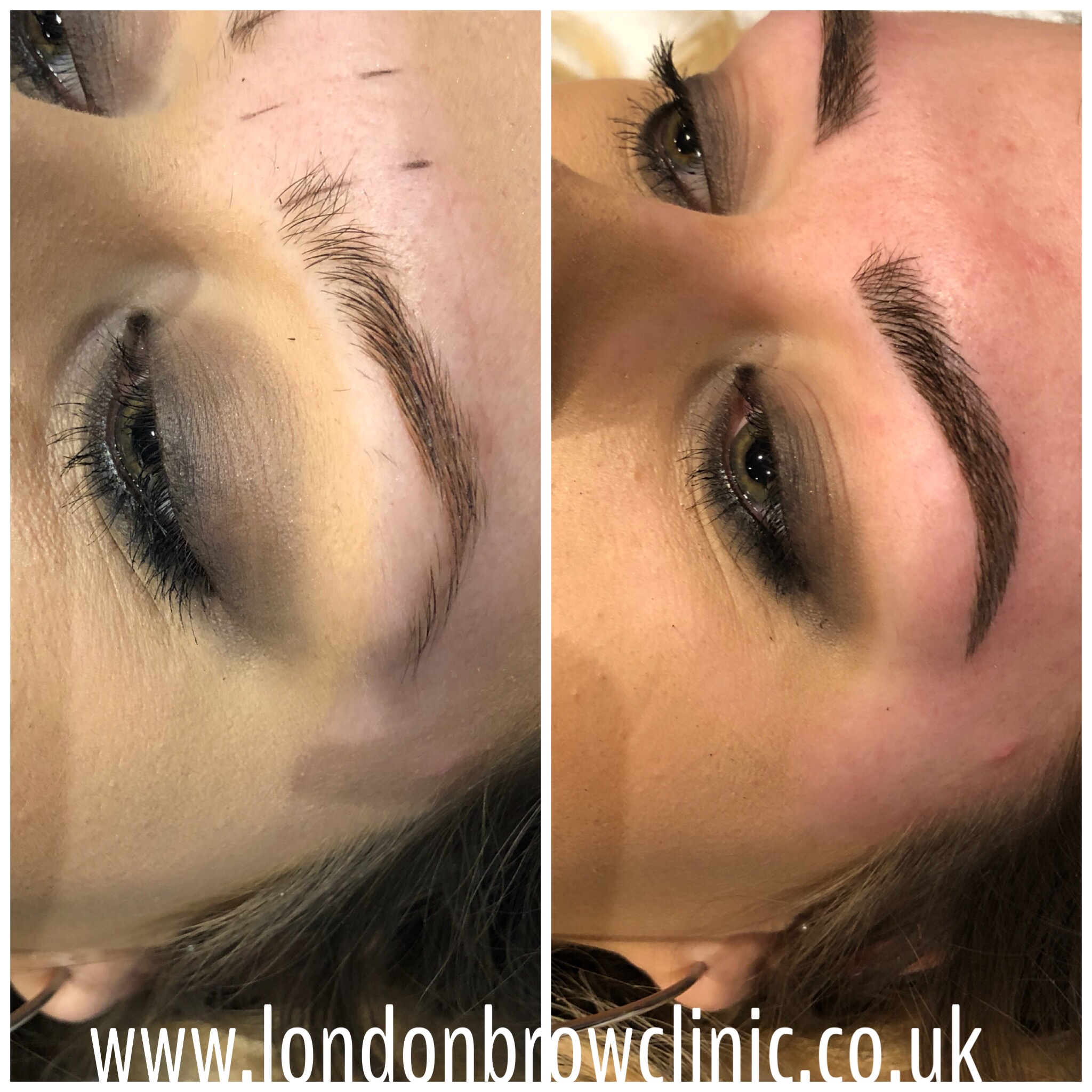 Microblading Specialist | London Brow Clinic | London