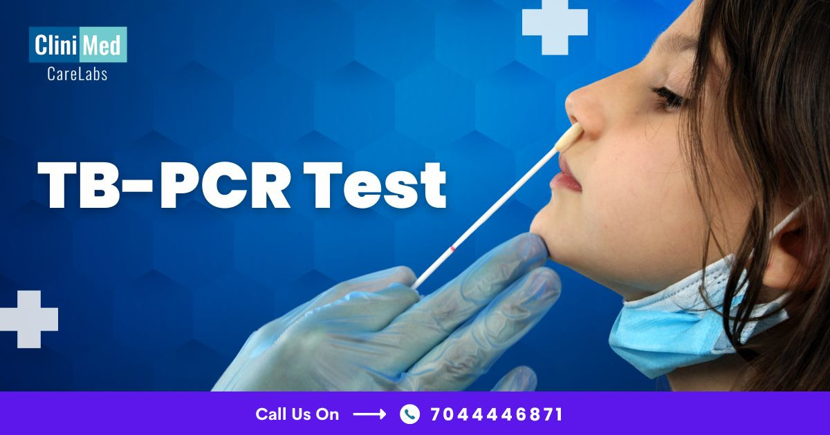 TB PCR Testing Center Kolkata CliniMed CareLabs tb-pcr-testing-center-kolkata-clinimed-carelabs