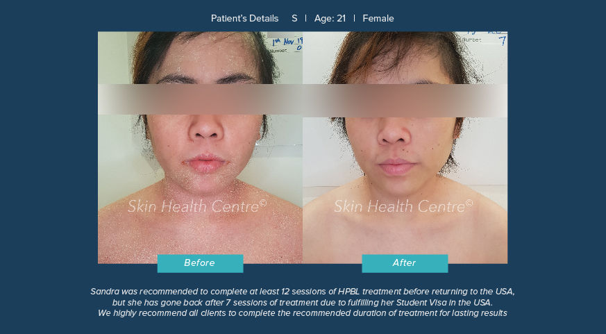 Red Skin Syndrome | Skin Health Centre