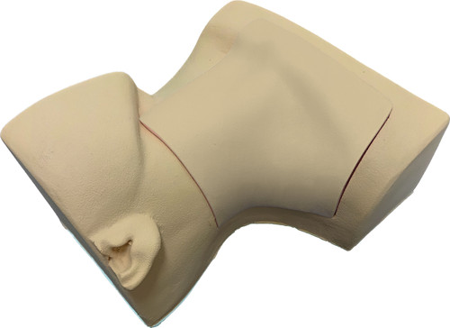 Interscalene/Supraclavicular/Deep Cervical/Stellate Ganglion Block ...