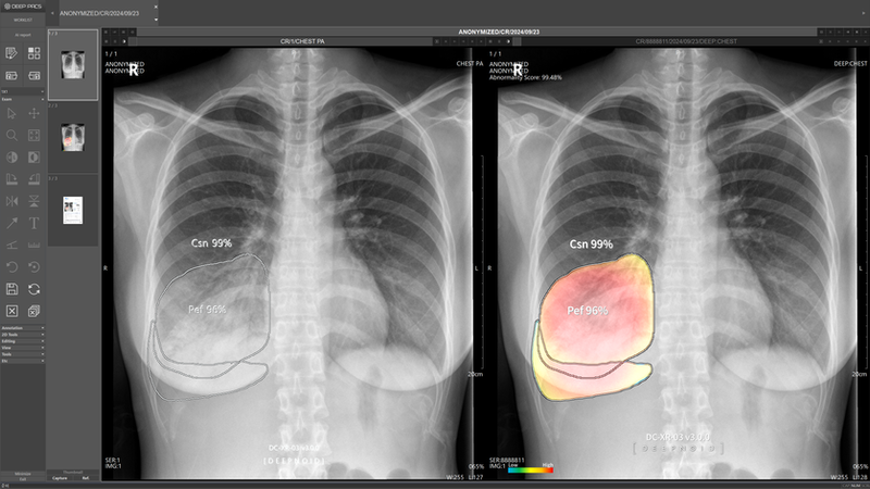 딥노이드 | AI in Everyday Life, DEEPNOID