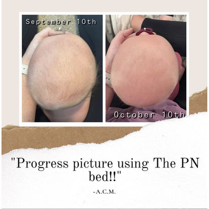 The PerfectNoggin Infant Head Shaping Surface