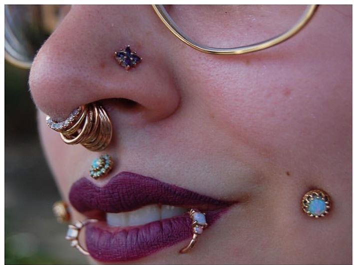 Cheeks 101- A Brief Overview