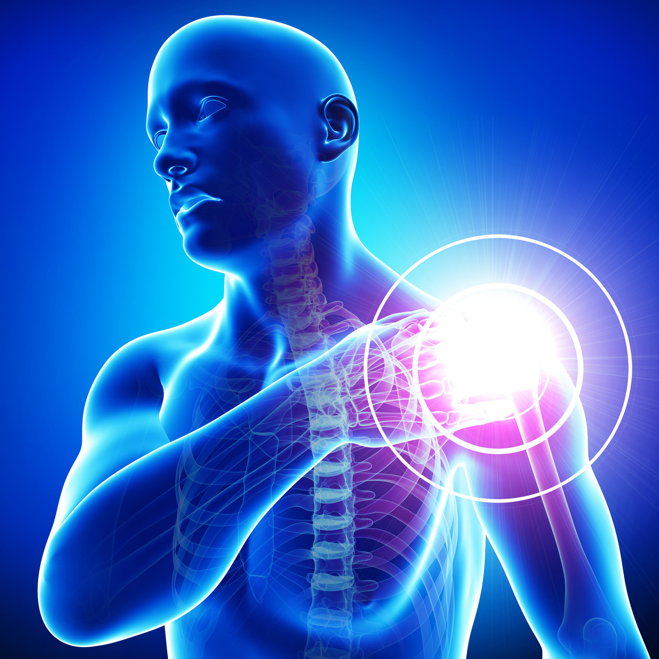 Shoulder Pain