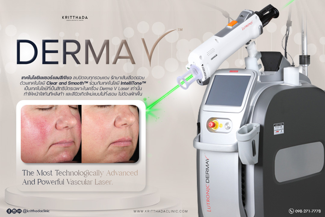 DERMA V LASER คืออะไร? เหมาะกับใคร? ทำที่ไหนดี?