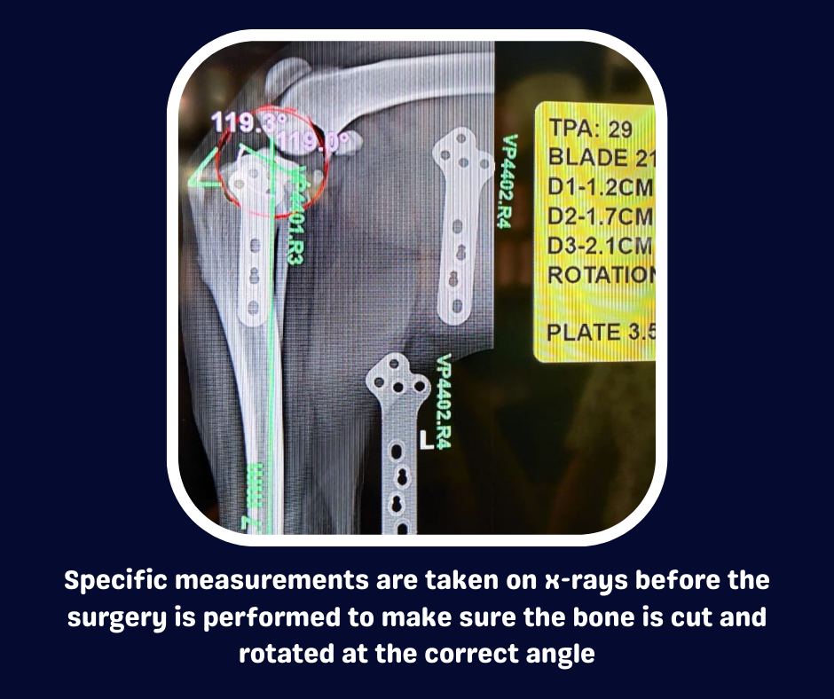 TPLO - tibial plateau levelling osteotomy