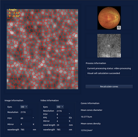 RETINOGRAFO FLUORANGIOGRAFO AUTOFLUORESCENZA ULTRAWIDE FIELD: SLO FA ...