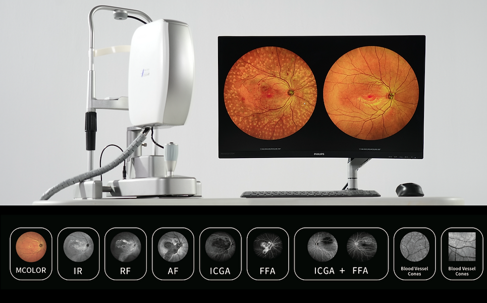 RETINOGRAFO FLUORANGIOGRAFO AUTOFLUORESCENZA ULTRAWIDE FIELD: SLO FA ...