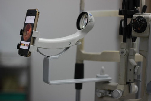 MIIT Retcam with Slit Lamp Mounting | MII RETCAM