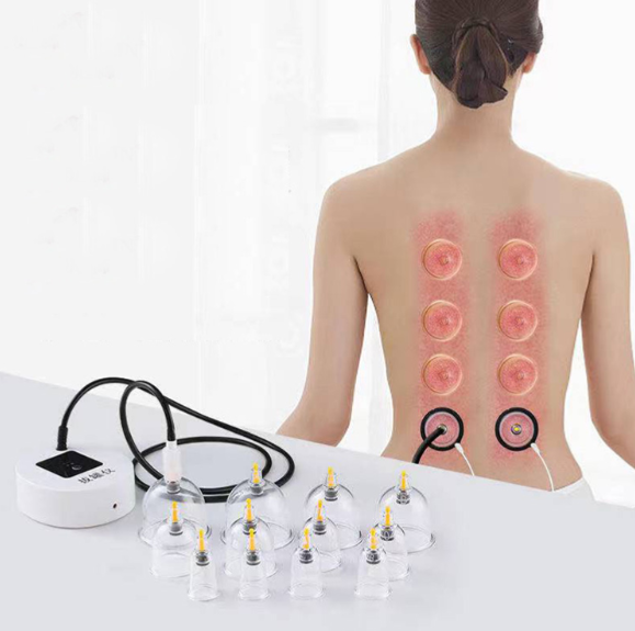 Electric Vacuum Cups Without Fire | Selectivtech