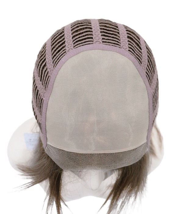 What is a Cranial Prosthesis?