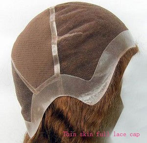 What is a Cranial Prosthesis?