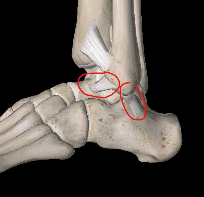 Blog 10- Understanding and Managing Lateral Ankle Sprains