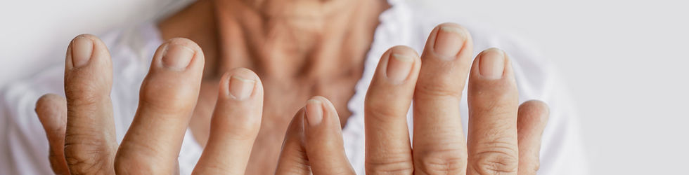 DIPJ Arthritis | Oceanside Ortho