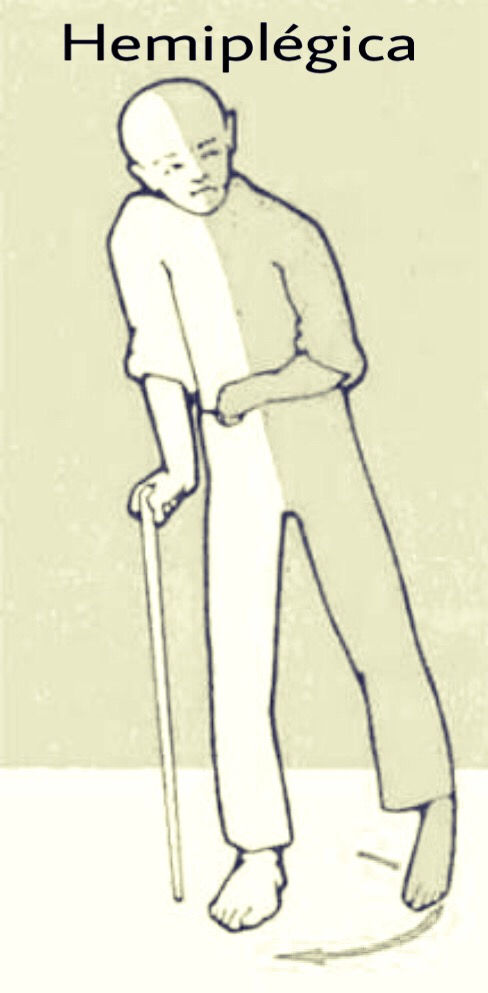 Caminhar pode identificar doenças?