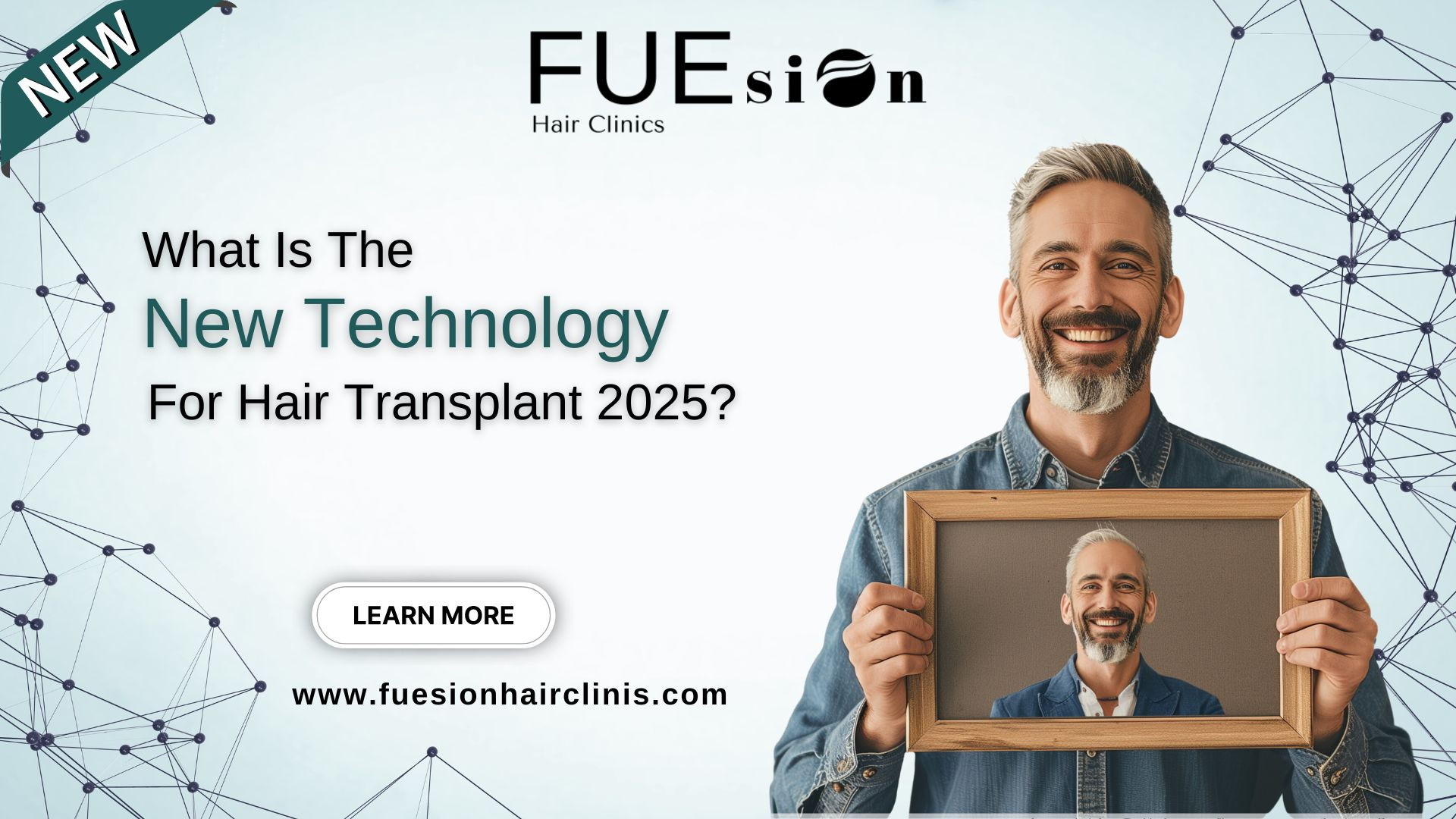 What is the New Technology for Hair Transplant 2025? – FUEsion Hair ...