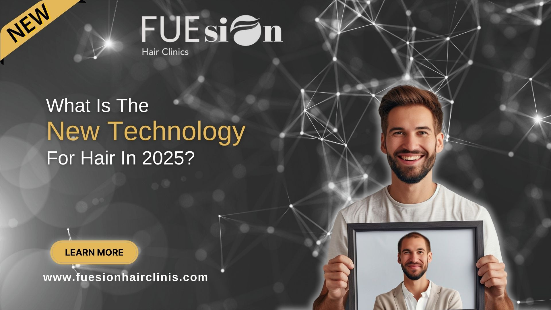 What Is the New Technology for Hair in 2025? Discover FUEsion Hair ...