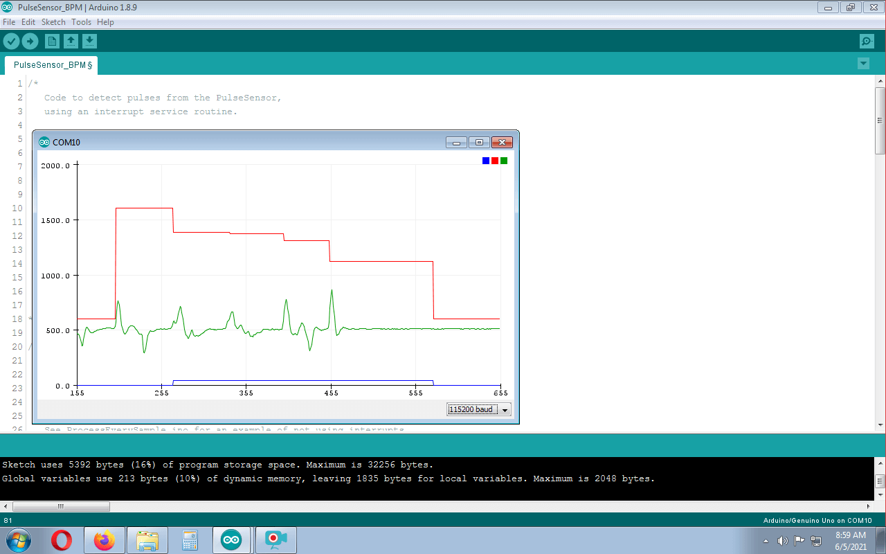Heart Beat Sensor Interface with Arduino and OLED display