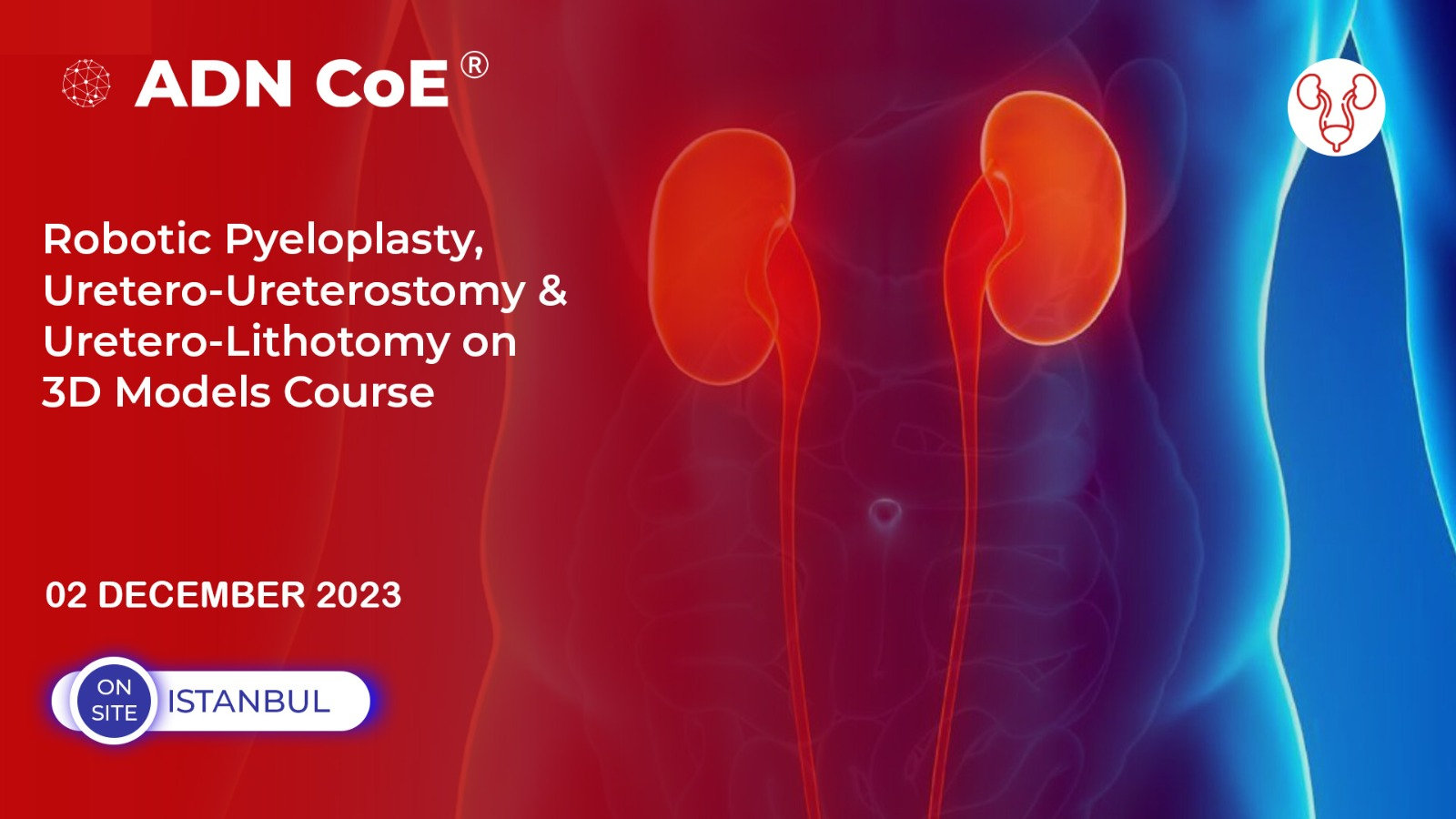 Robotic Pyeloplasty, Uretero-Ureterostomy & Uretero-Lithotomy on 3D ...