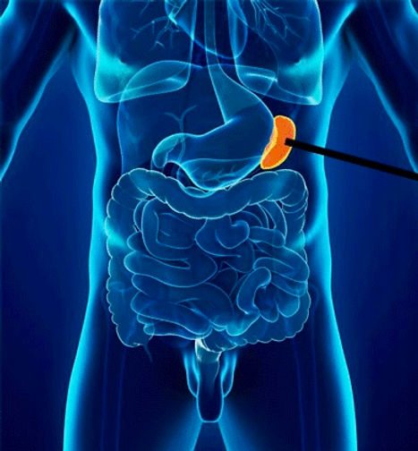 Approach to Management and Prevention of Infections in the Asplenic Patient