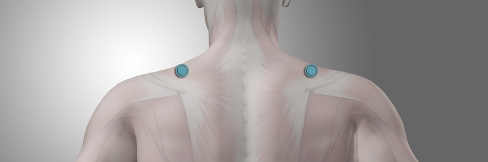 3 Awesome Acupressure Points for Shoulder Tension and Neck Pain