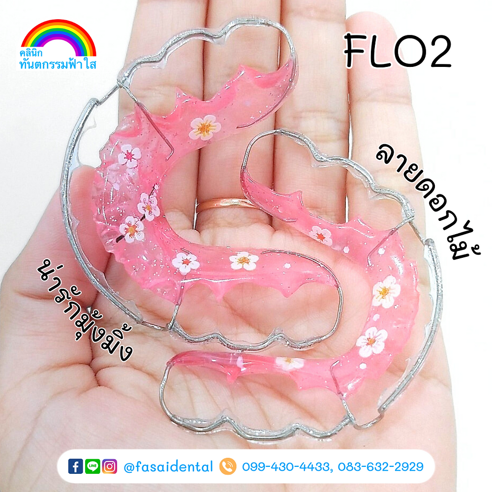 รีเทนเนอร์ลาย FLO2