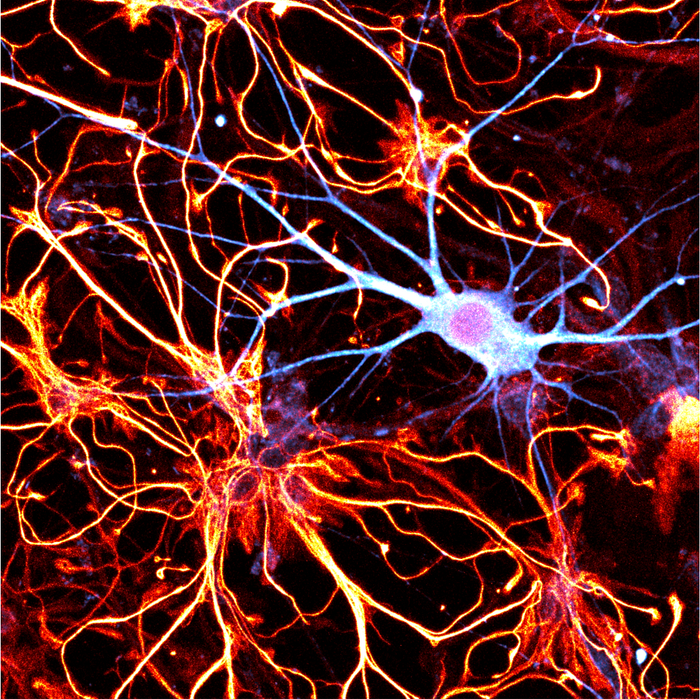 Fluorescence Microscopy: Visualising Cells