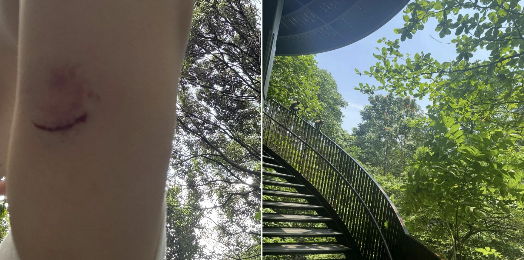 Understanding the Risks of Monkey Bites in Singapore