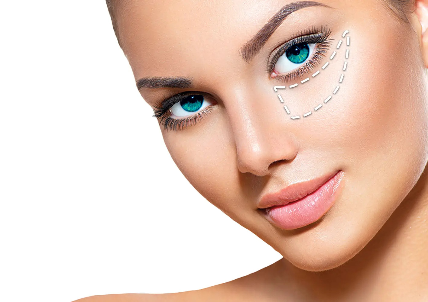 Tear Troughs and How Tear Trough Filler Treatments Can Help