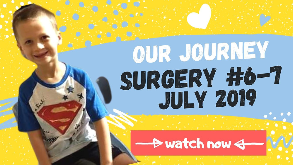 Surgery #6-7- Tubes & Furlow Palatoplasty