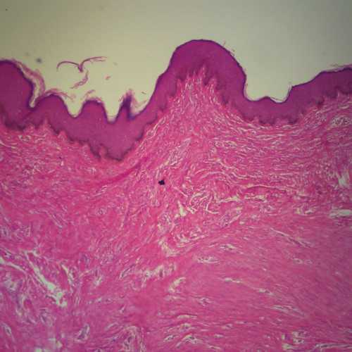 Human Heavily Pigmented Skin sec. 7 µm H&E stain Microscope Slide ...