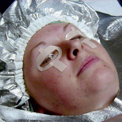 Cornea-Care Eye Protection Dressing | Suntime