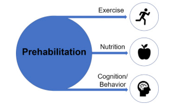 Prehabilitation- what is it?