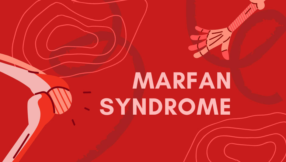 Marfan Syndrome