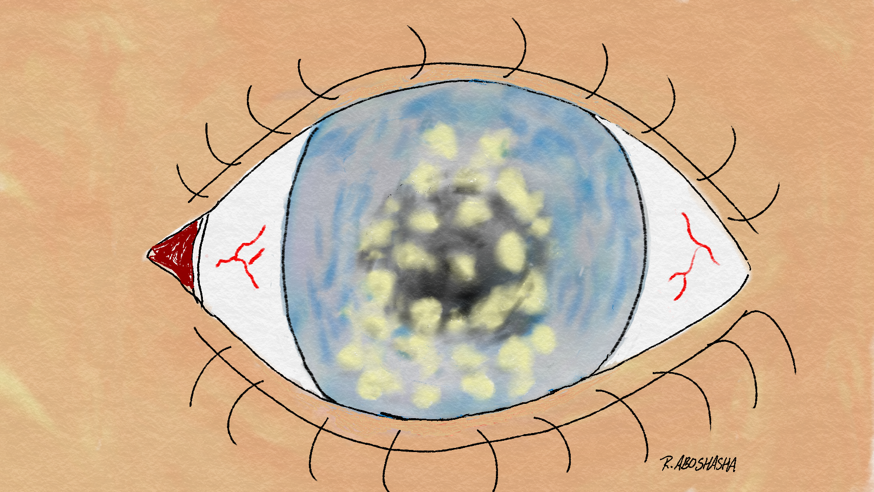 Dr. Rami Shasha, MD, FRCSC