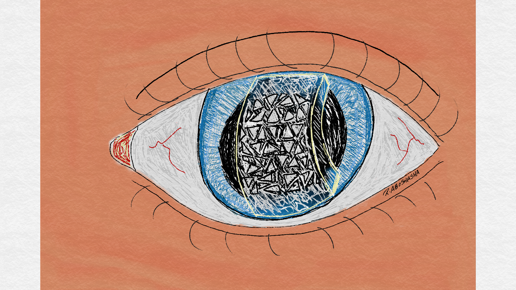 Dr. Rami Shasha, MD, FRCSC