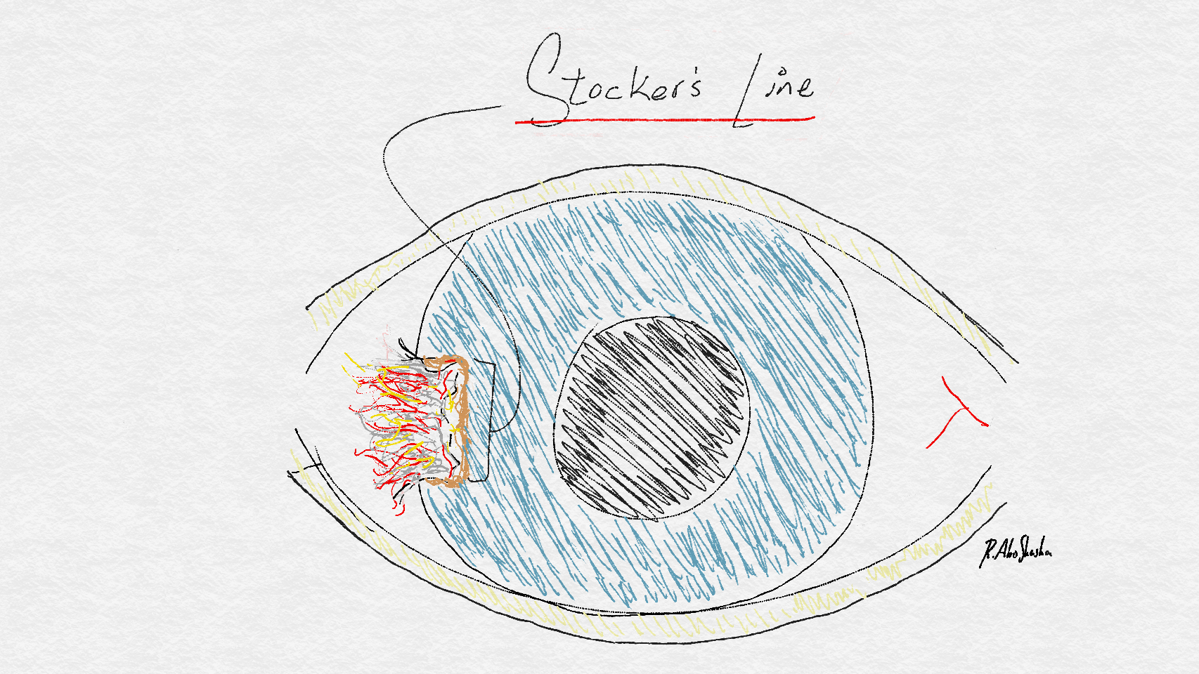 Dr. Rami Shasha, MD, FRCSC