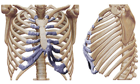 Ravitch Procedure | Pectus Notebook