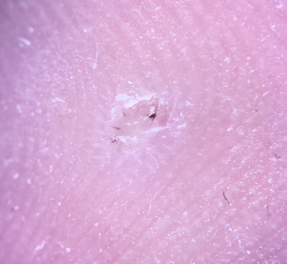 ¿Cuál es el diagnóstico?