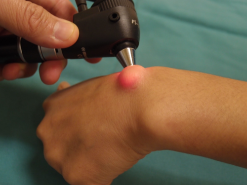 Common Masses in the Hand