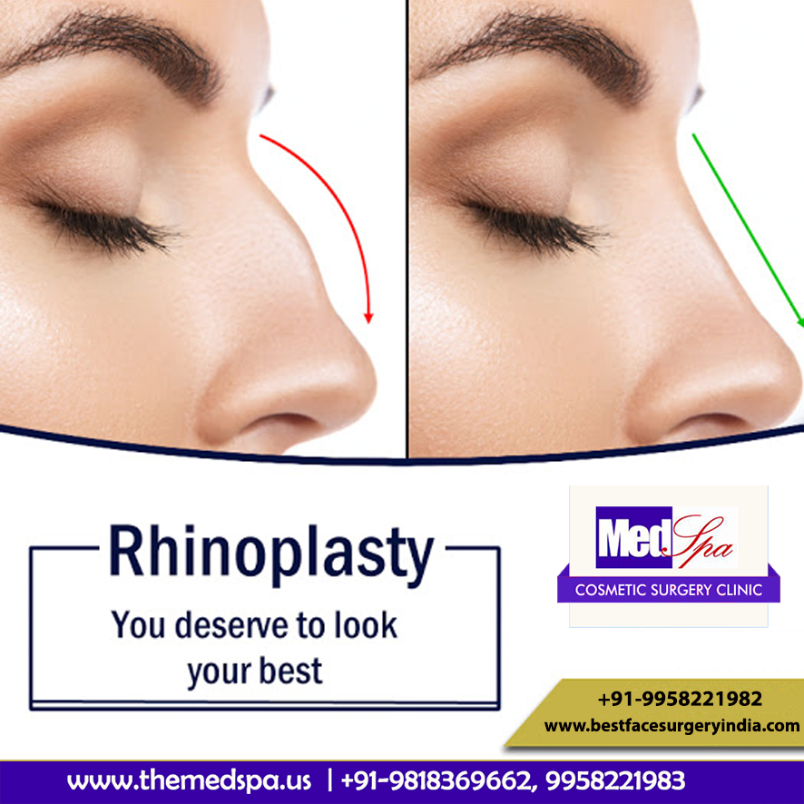 Rhino Plastic Surgery